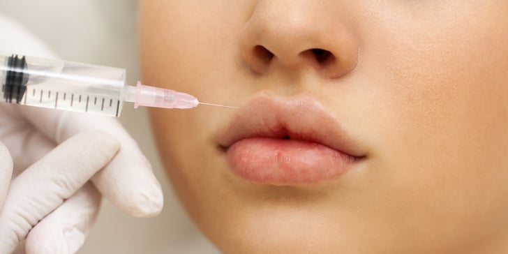Keyhole Lip Filler: Before and Afters, Costs, Risks | POPSUGAR Beauty UK