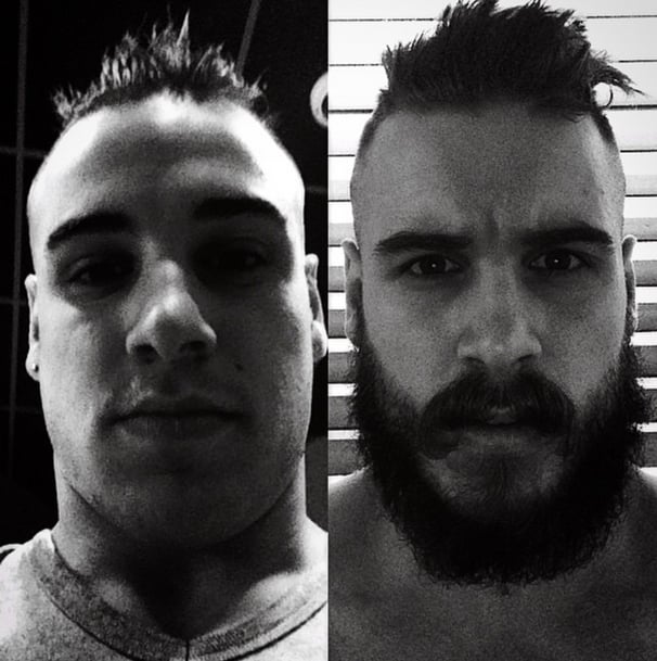 Before and After Beard Transformations | POPSUGAR Beauty