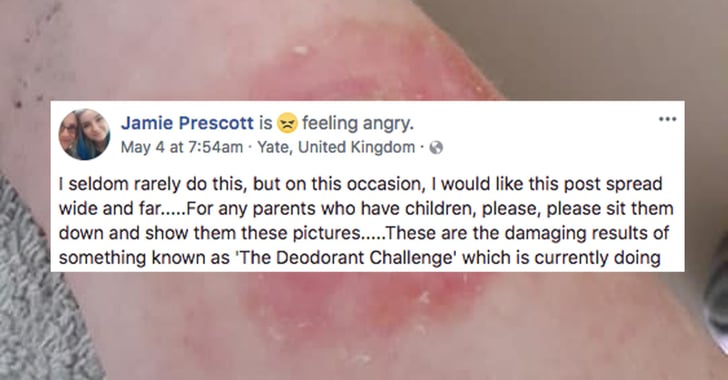 What Is the Deodorant Challenge? | POPSUGAR Family