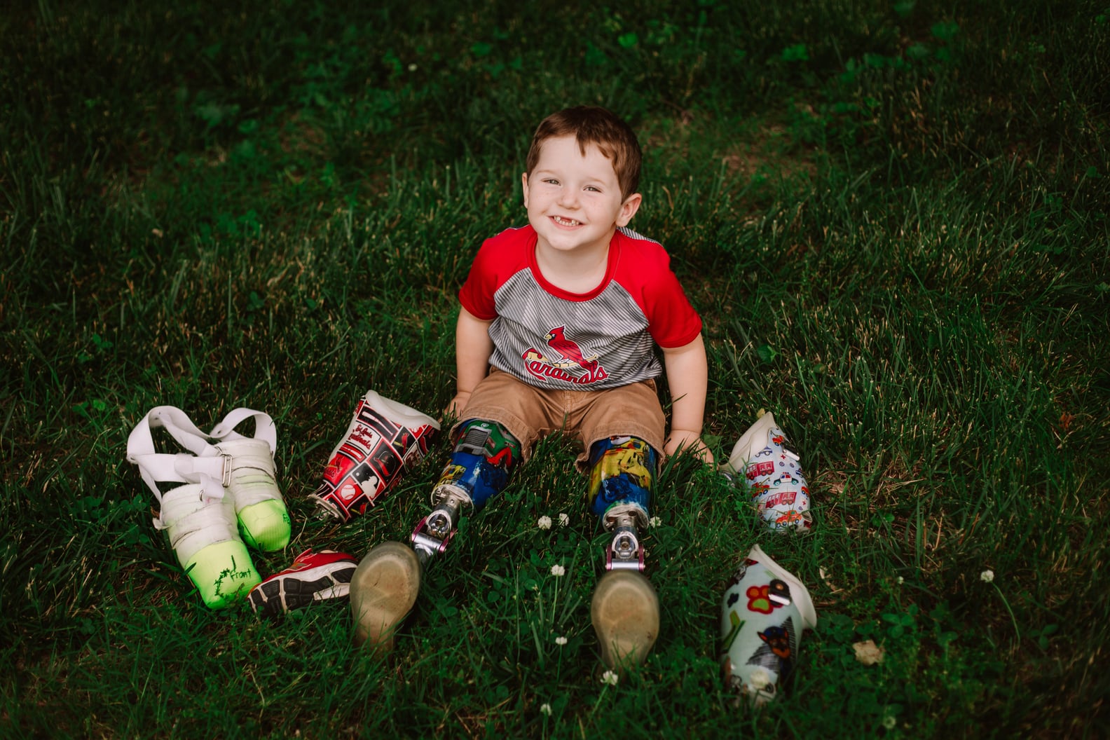 Photo Shoot of Toddler Who Lost Both Legs | PS Family