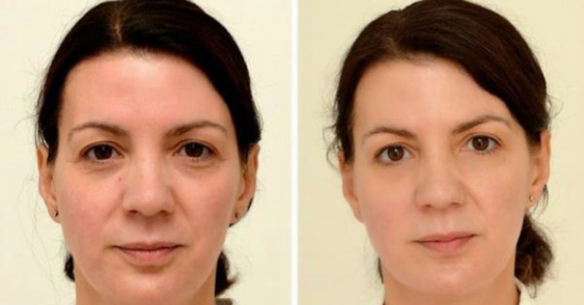 How Your Face Changes When You Drink Water | PS Fitness