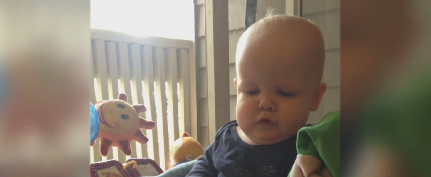 Baby With Abnormal Head Shape | PS Family