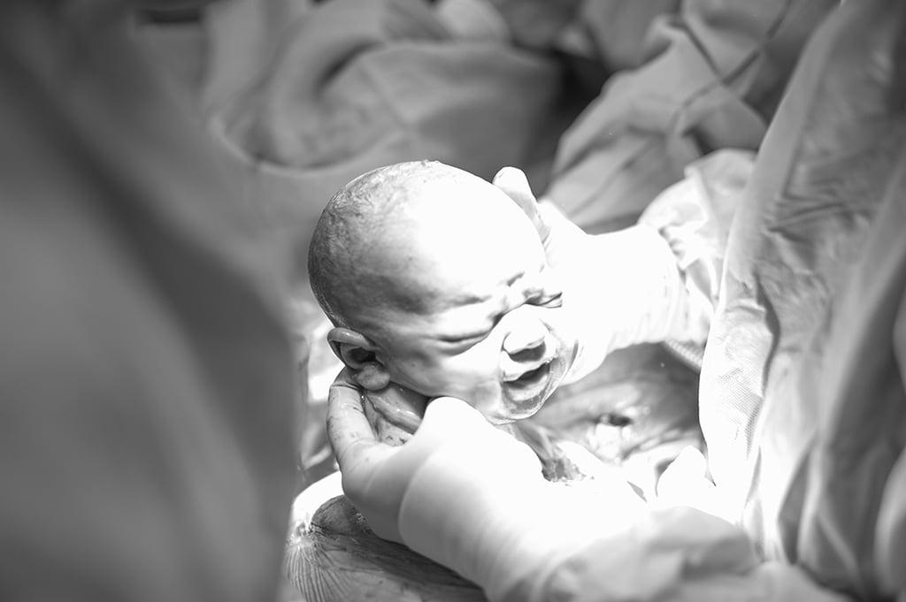 Photos of C-Sections | POPSUGAR Family