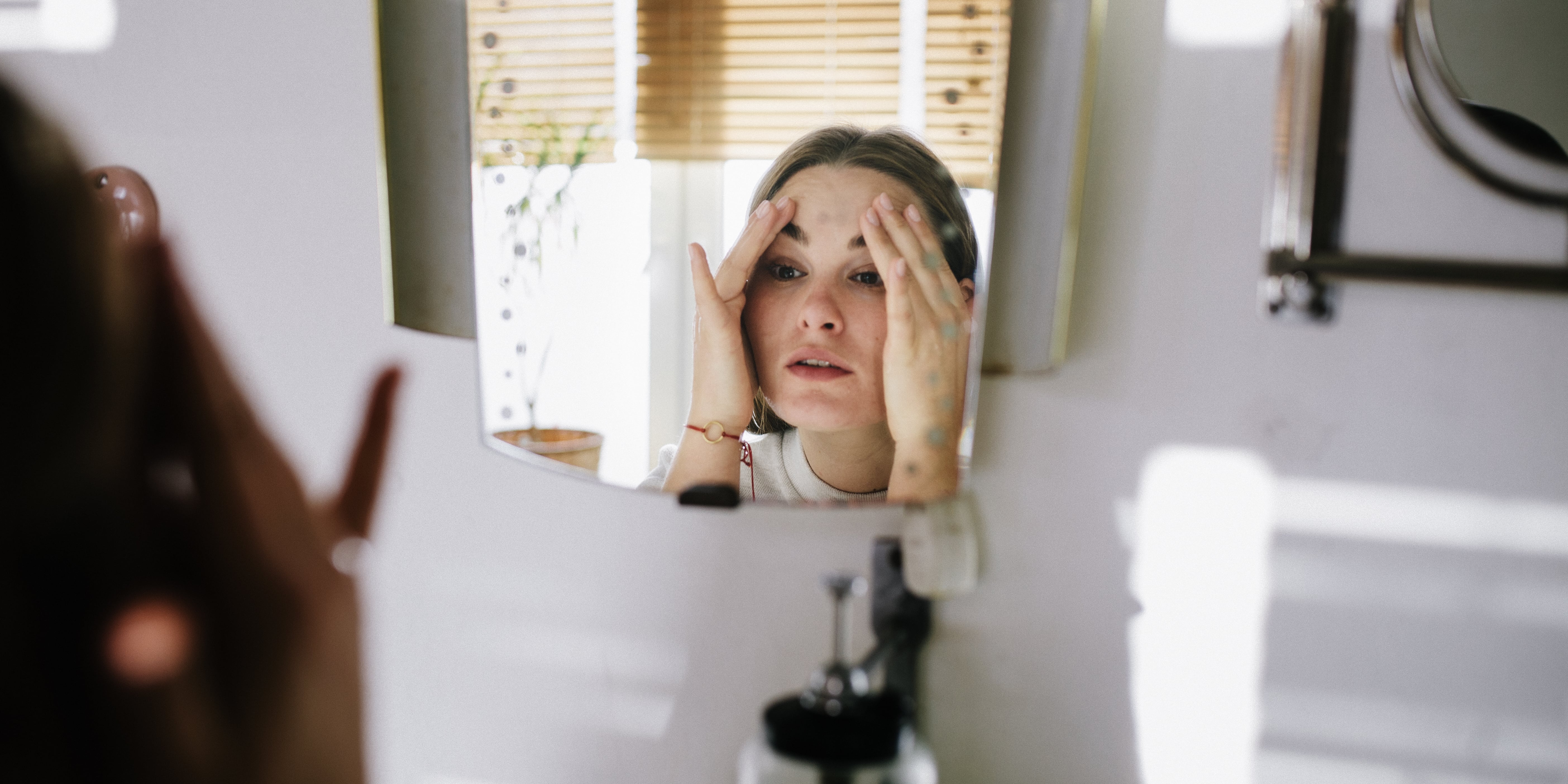 What It's Like Living With Cortisol Face | PS Health
