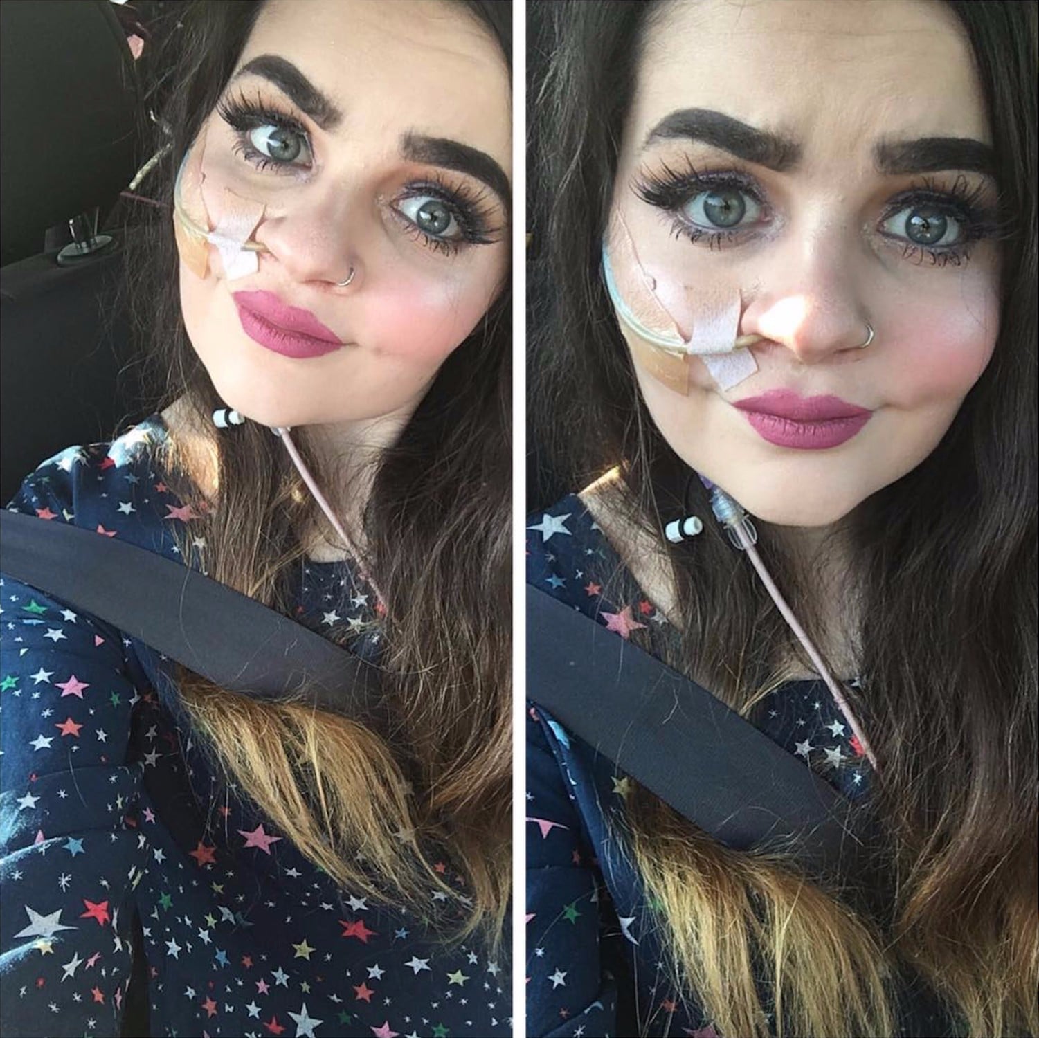 Emily Jones Makeup Artist With Feeding Tube | POPSUGAR Beauty