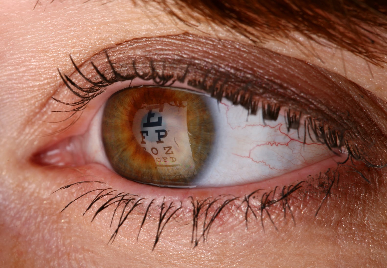 Is LASIK Safe? 2 Ophthalmologists Weigh In | PS Health
