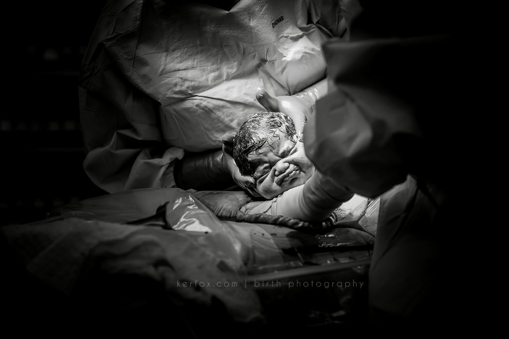 Best Birth Photos 2016 | POPSUGAR Family