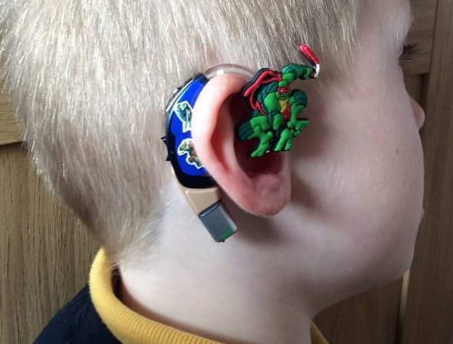 Mom Creates Superhero Hearing Aids For Son | PS Family