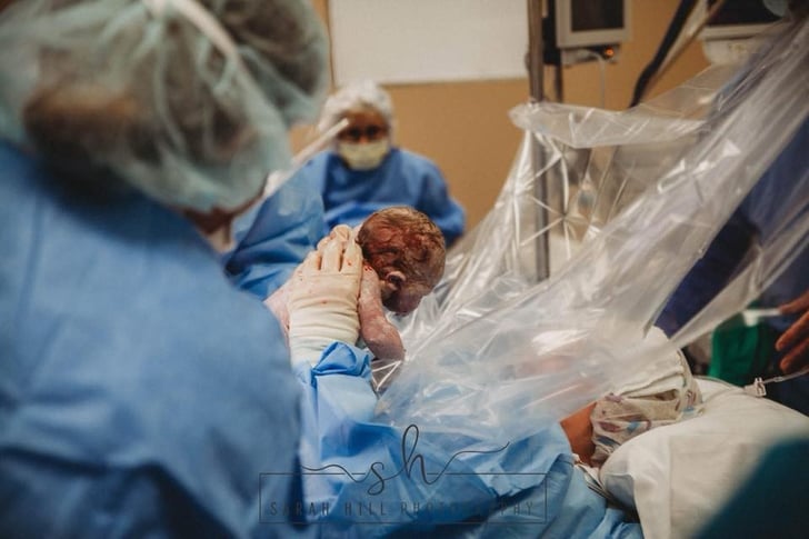 Midwife Delivers Own Baby Via C-Section | POPSUGAR Family