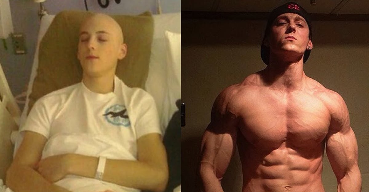 Cancer Patient Bodybuilder | PS Fitness