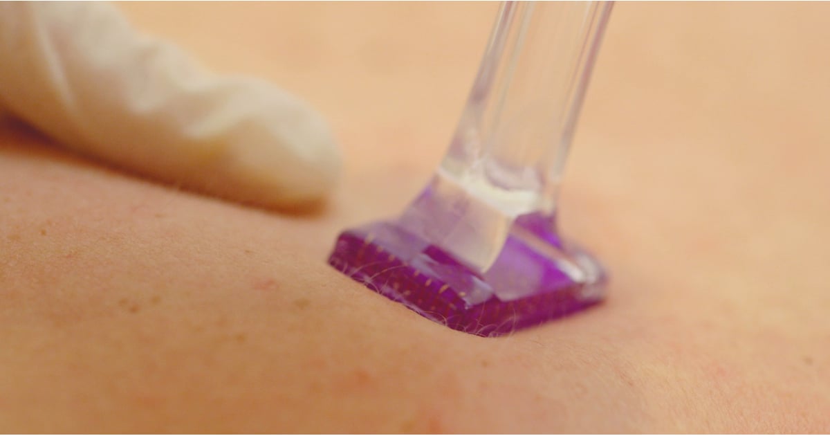 Back Facial For Acne | POPSUGAR Beauty