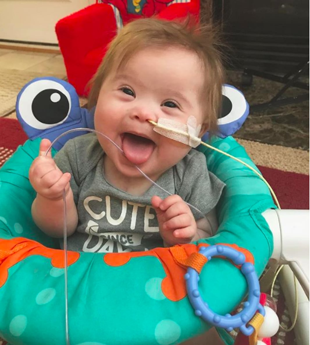 Photos of Babies With Down Syndrome | PS Family