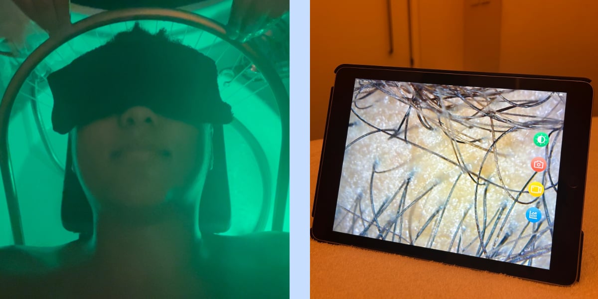 The Viral Head Spa Treatment Transformed My Scalp | PS UK Beauty