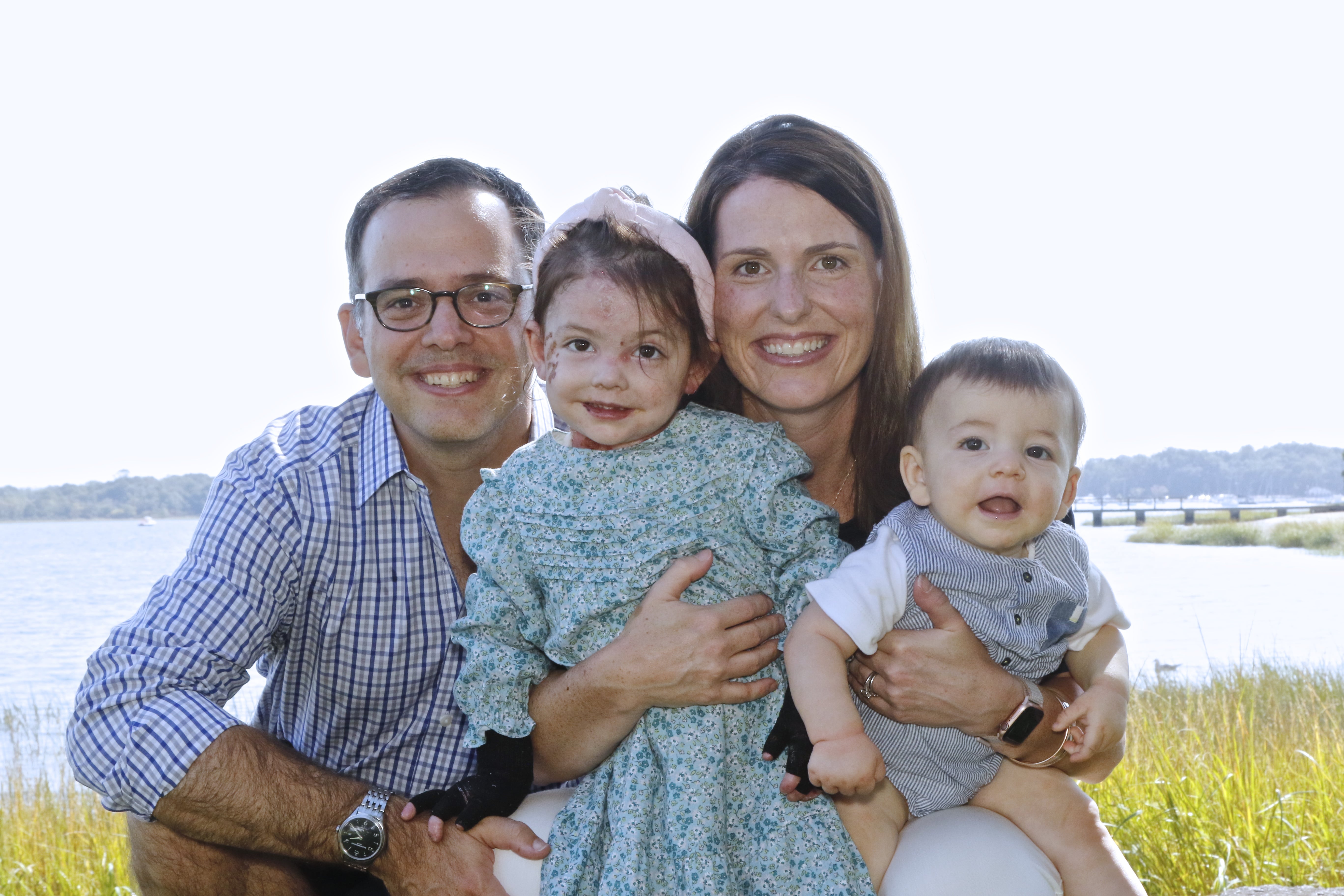 dystrophic epidermolysis bullosa life expectancy