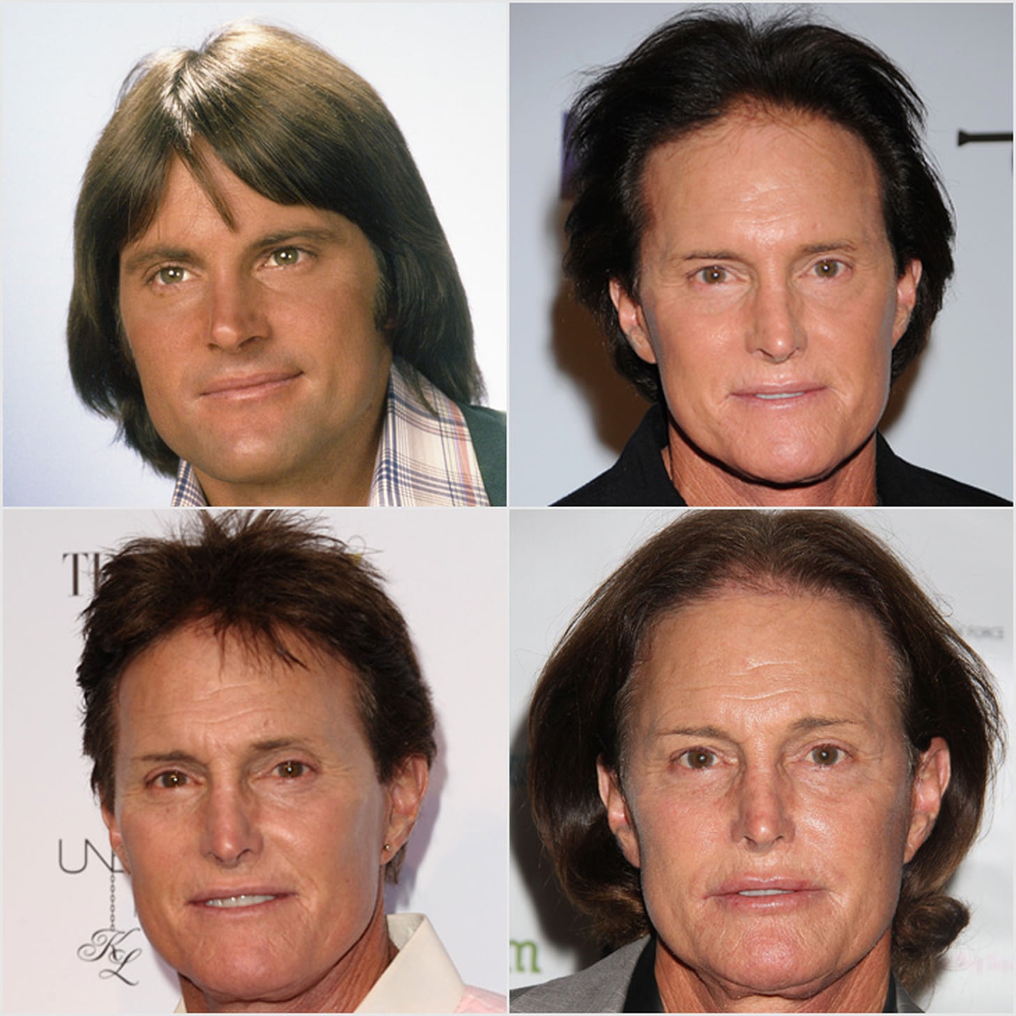 Bruce Jenner's Transformation | PS Beauty