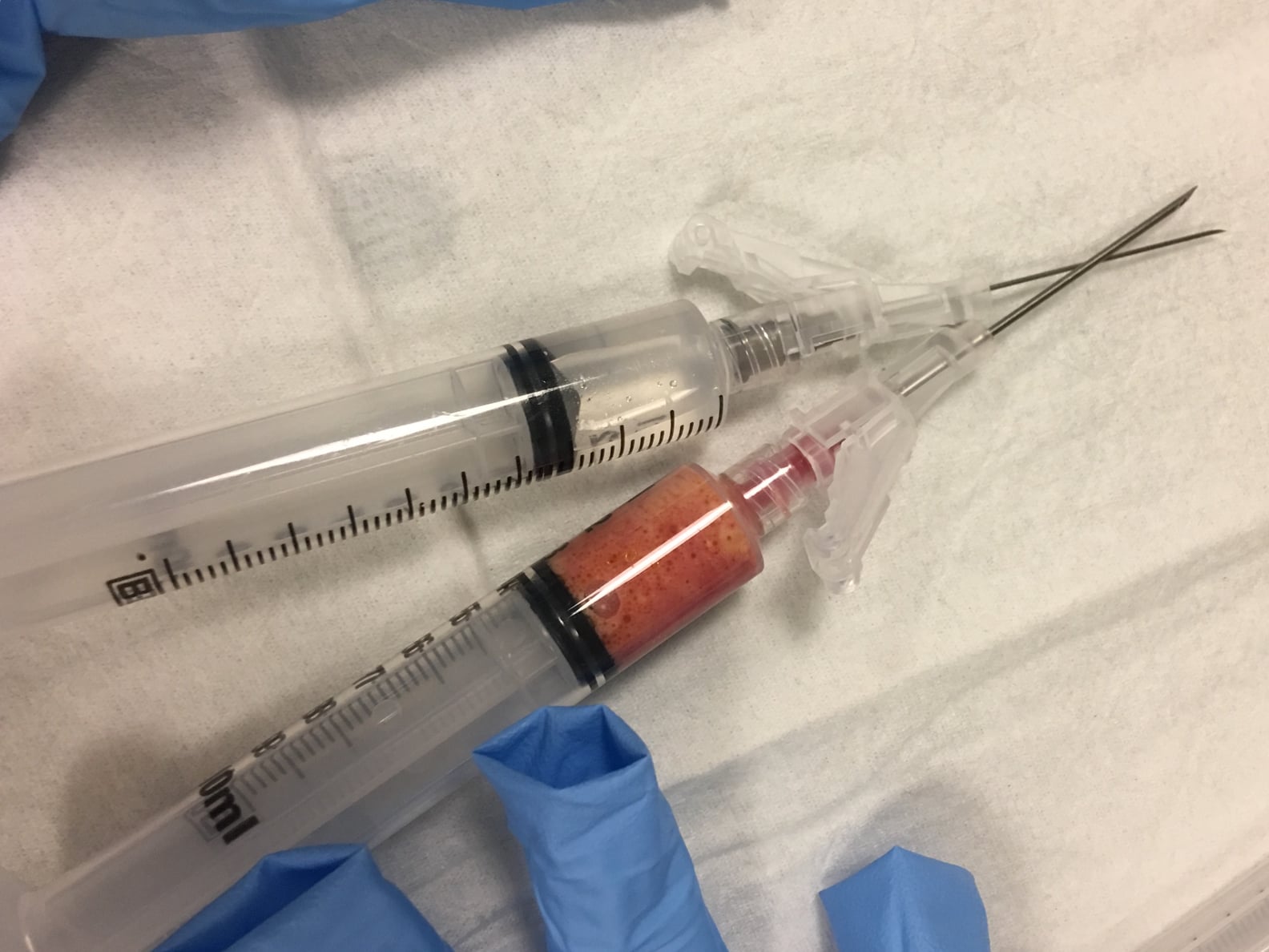 Does Breastfeeding Hurt? | PS Family