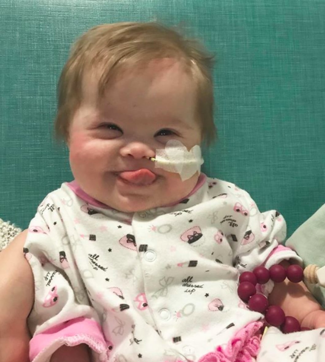 Photos of Babies With Down Syndrome | PS Family