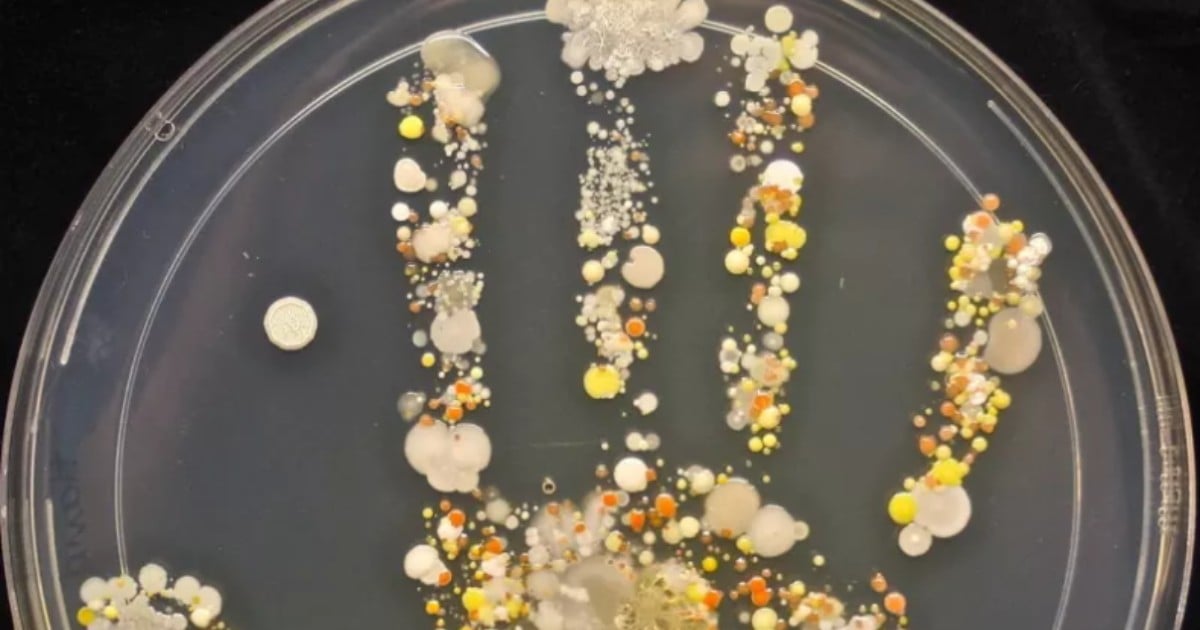 Photo of Bacteria on 8-Year-Old Boy's Hand | POPSUGAR Family