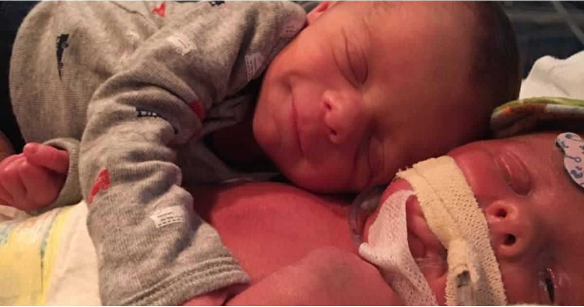 Photo Of Twins Hugging Goes Viral Before 1 Twins Death Popsugar Moms