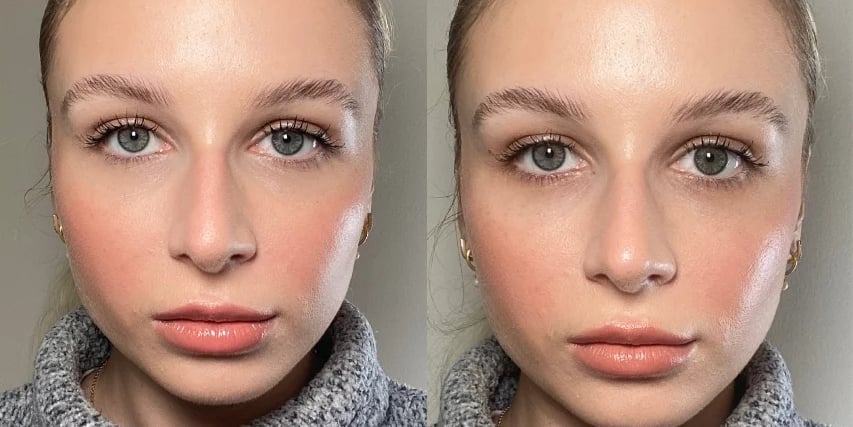 Upneeq Eye Drops Review With Photos | POPSUGAR Beauty