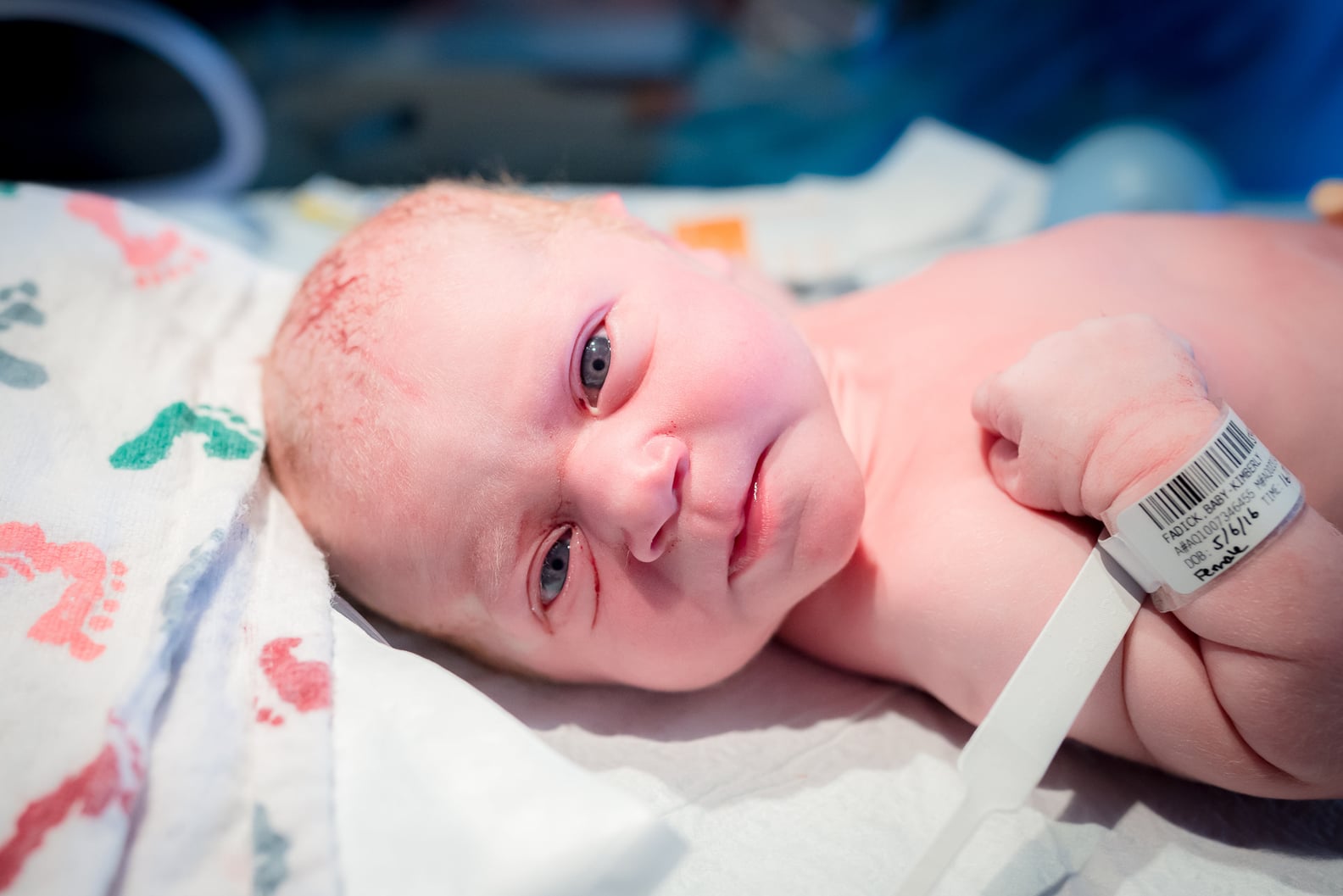 Baby Born With Umbilical Cord Wrapped Around Her Stomach | PS Family