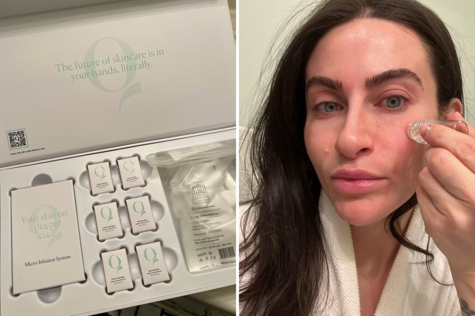Qure Micro-Infusion System Review With Photos | PS Beauty