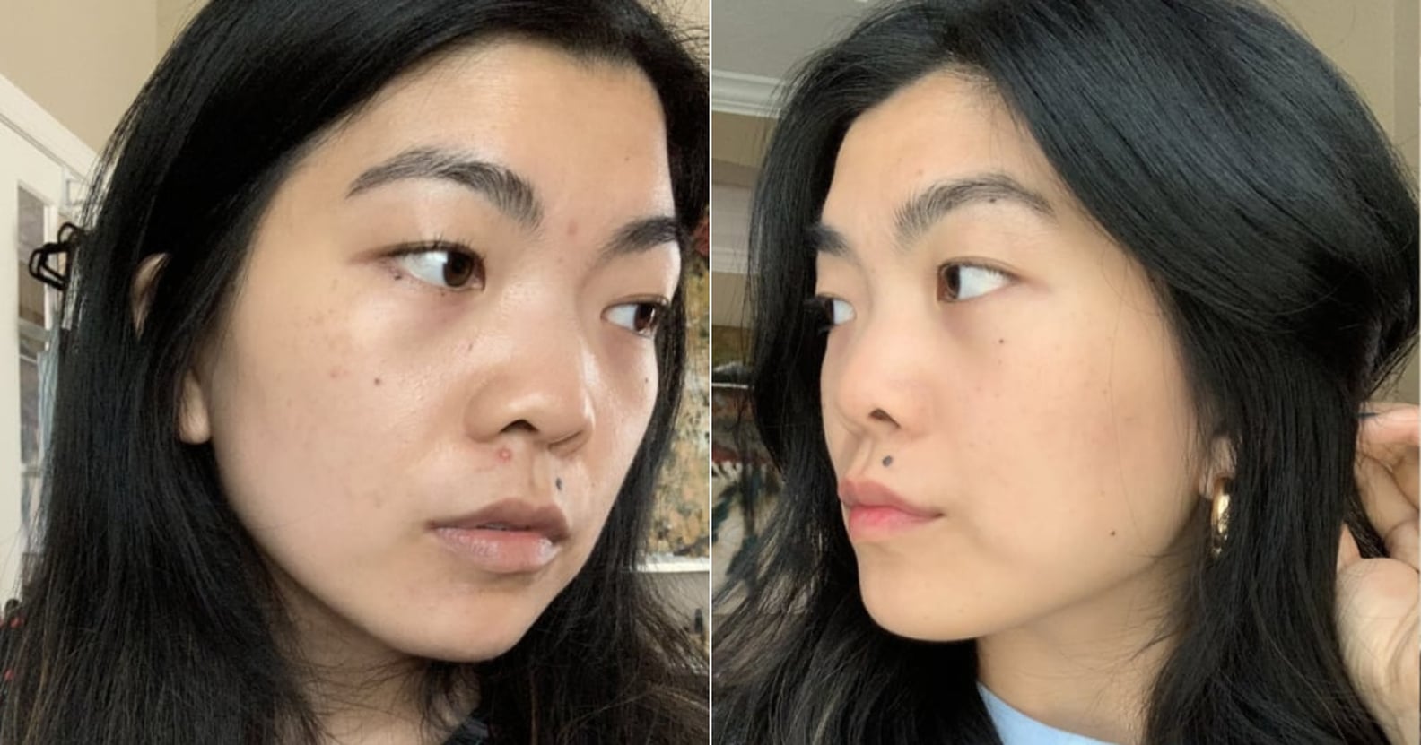 Curology Skin-Care Review | POPSUGAR Beauty