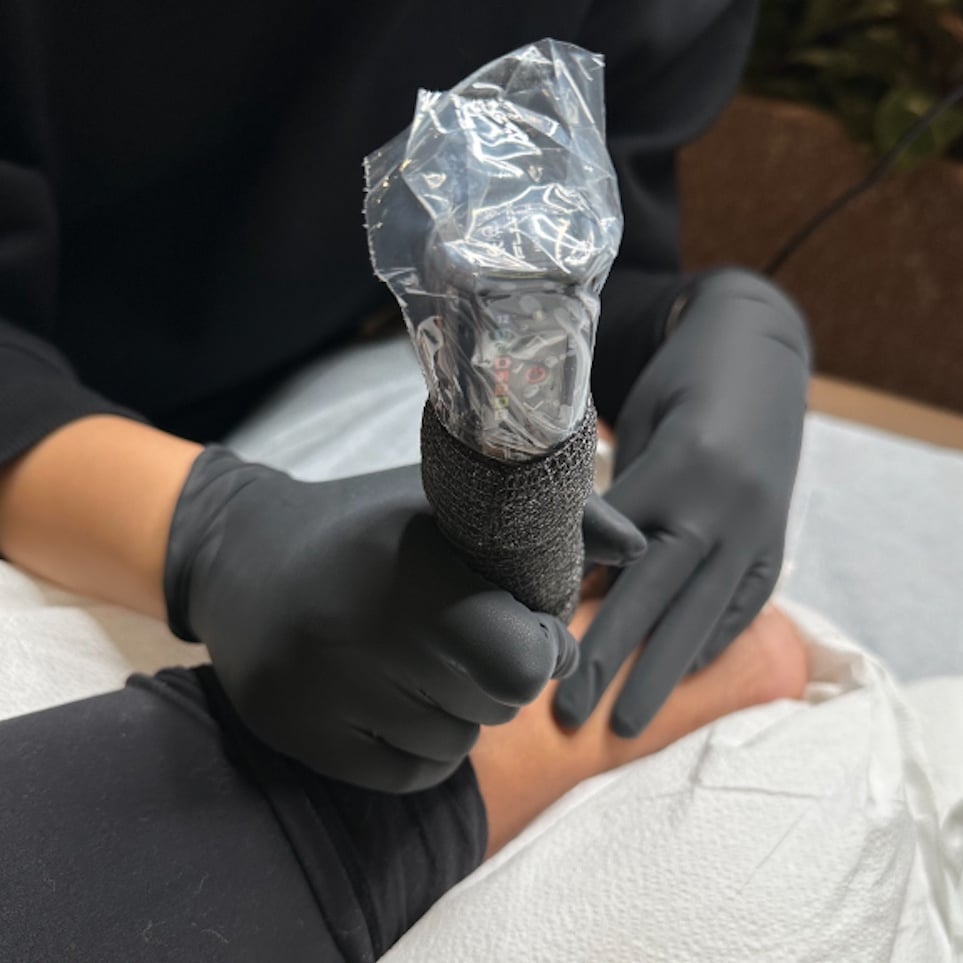 Mad Rabbit Tattoo Repair Patch Review With Photos | POPSUGAR Beauty UK