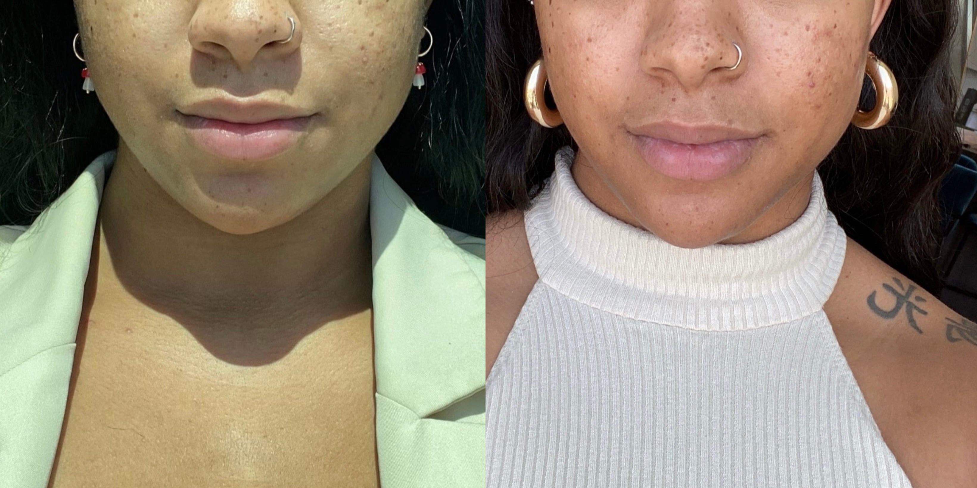 I Tried the Celebrity-Favorite Forma Facial Treatment | POPSUGAR Beauty