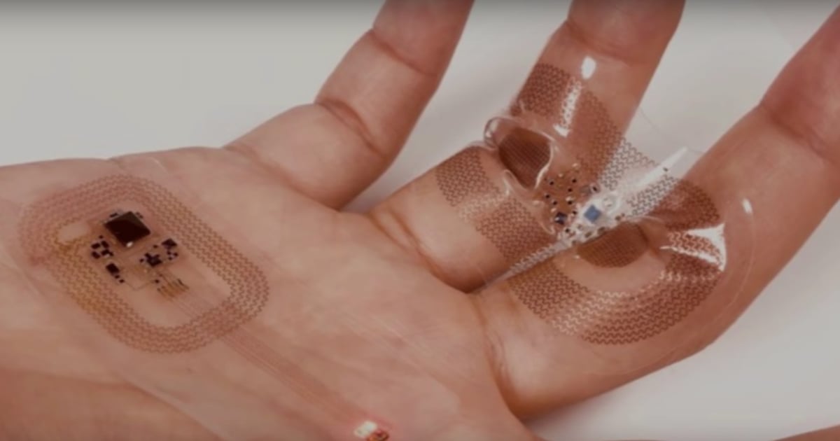 Wireless Technology For NICU Babies | POPSUGAR Family