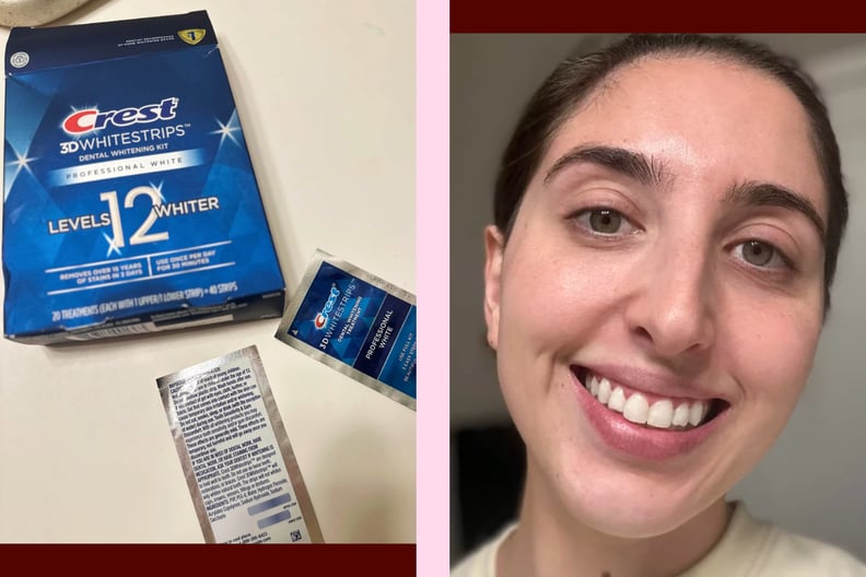 Crest Whitening Strips Review From a Beauty Editor | PS Beauty