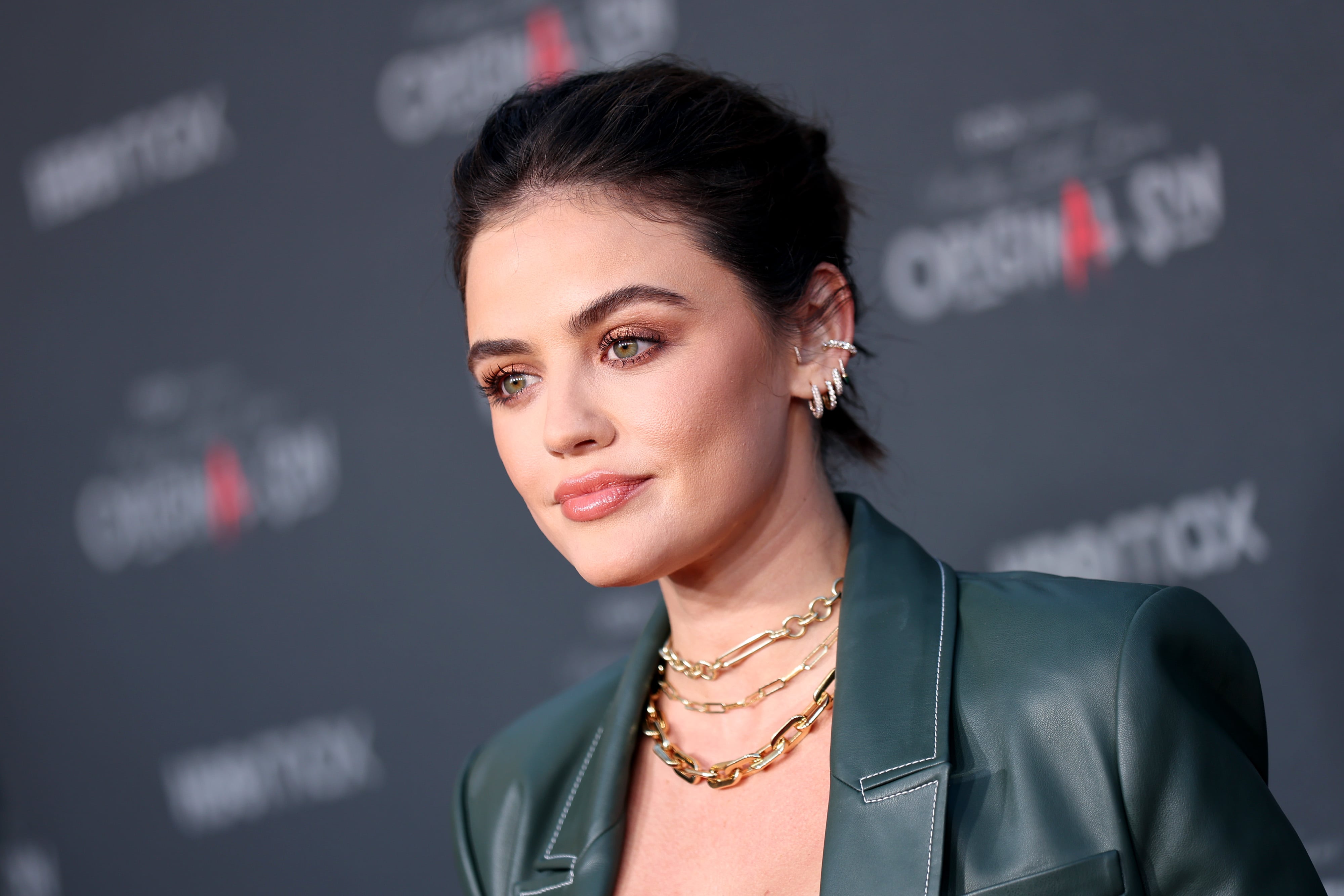 Lucy Hale Bad Skin