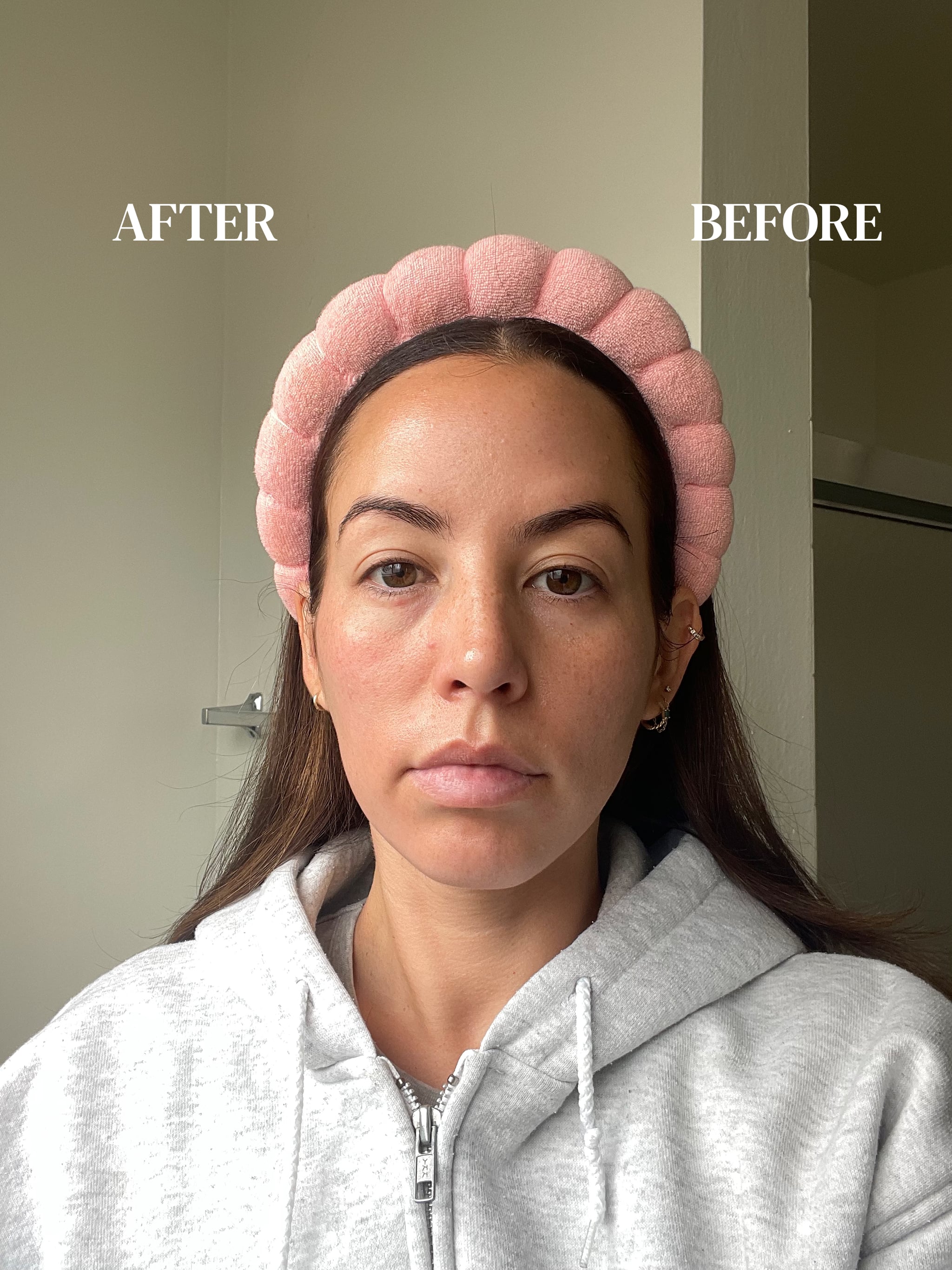 MyoLift Triwave Facial Toning Device Review With Photos | POPSUGAR ...