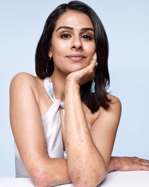 Dove Make Peace With Your Dry Skin Campaign | PS Beauty