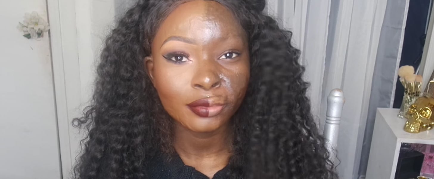 Burn Victim Makeup Transformation | Makeupview.co