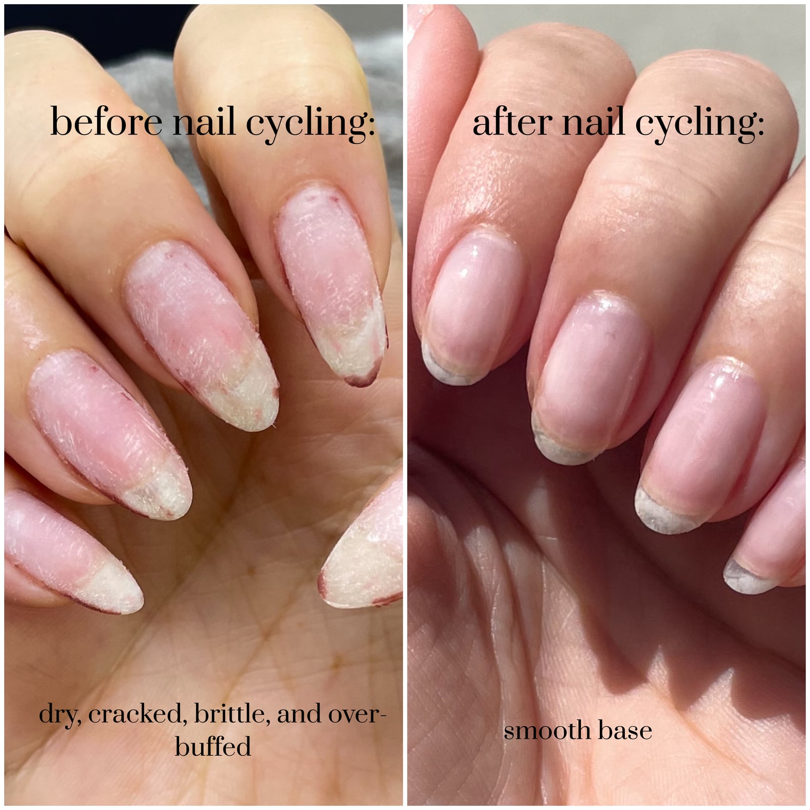 I Tried Nail Cycling: See Photos | PS Beauty
