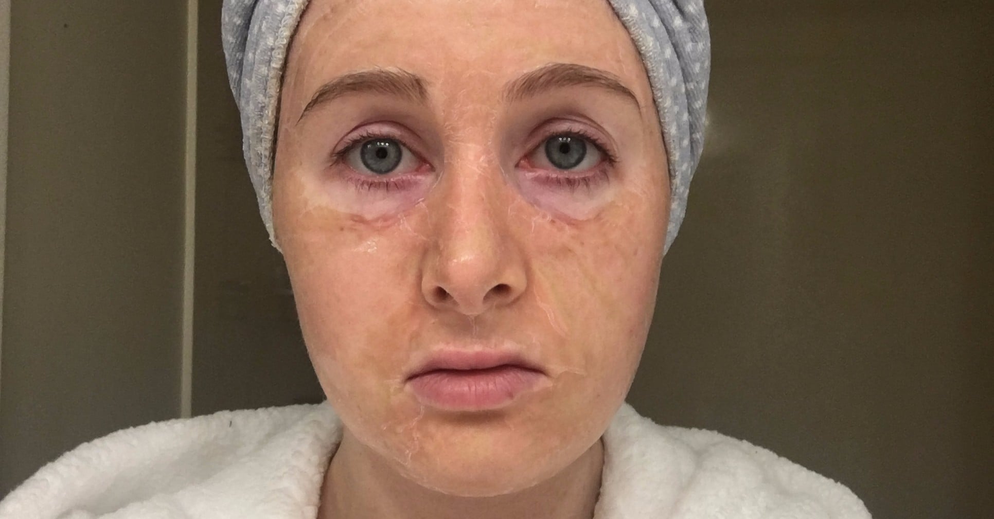 Hanacure Mask Review | POPSUGAR Beauty