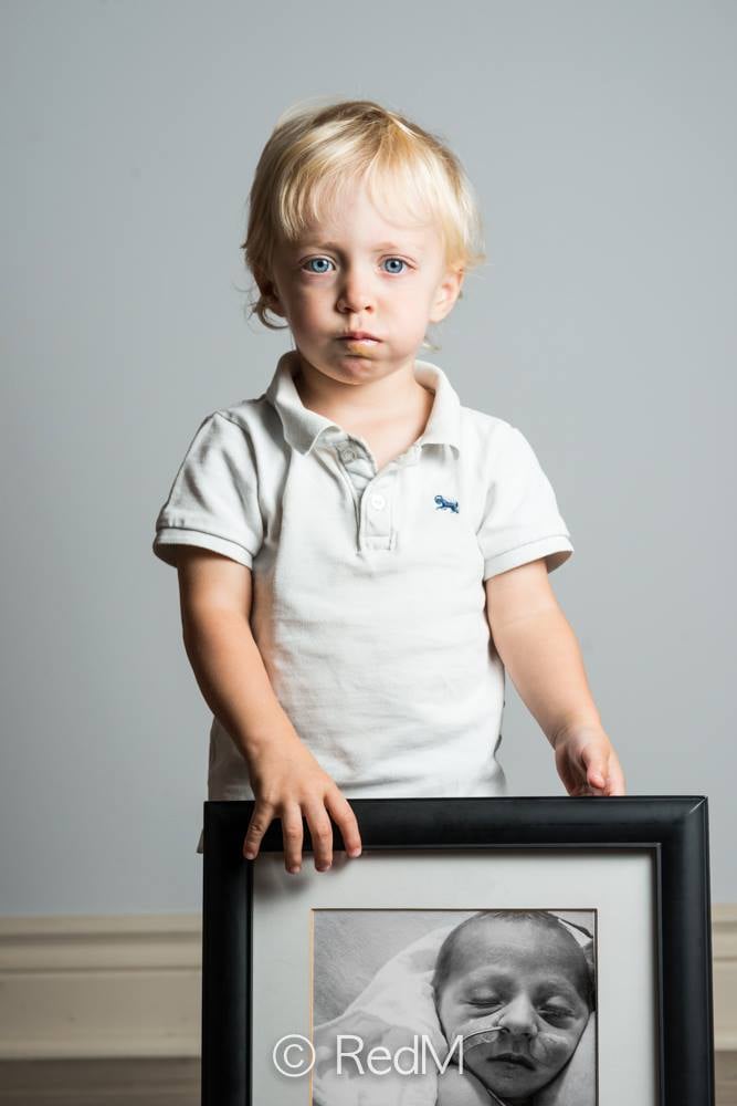 Then and Now Photos of Kids Who Were Born Premature | POPSUGAR Family