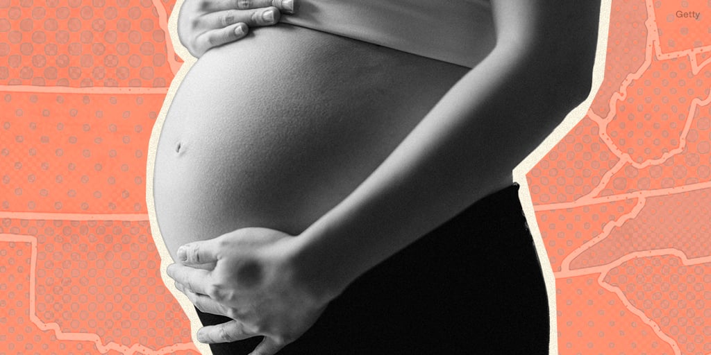 How Doulas Can Help Fight Trump's Maternal Health Policies | PS Health