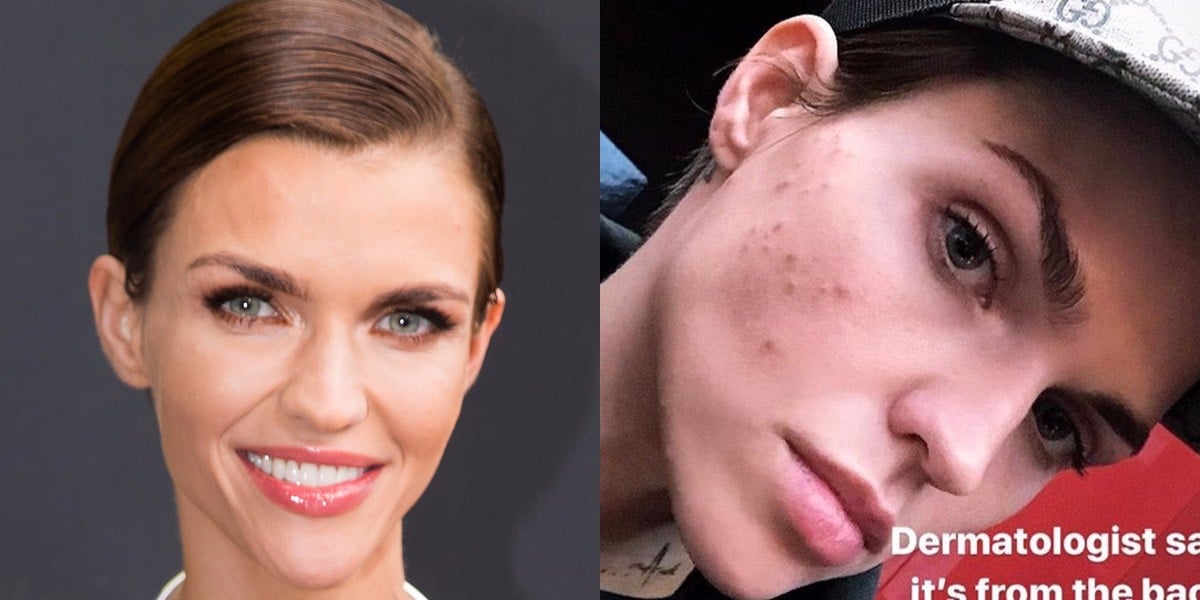 Ruby Rose Responds to Acne Weight Scrutiny | PS Beauty