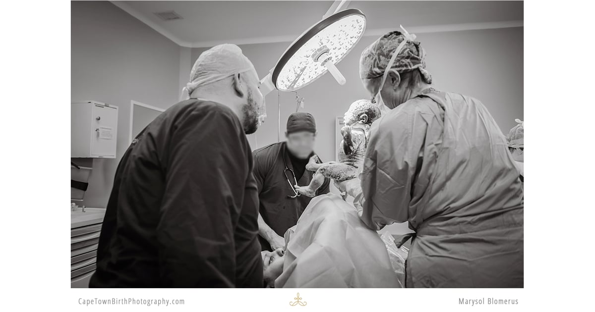 Photos of C-Sections | POPSUGAR Family Photo 21