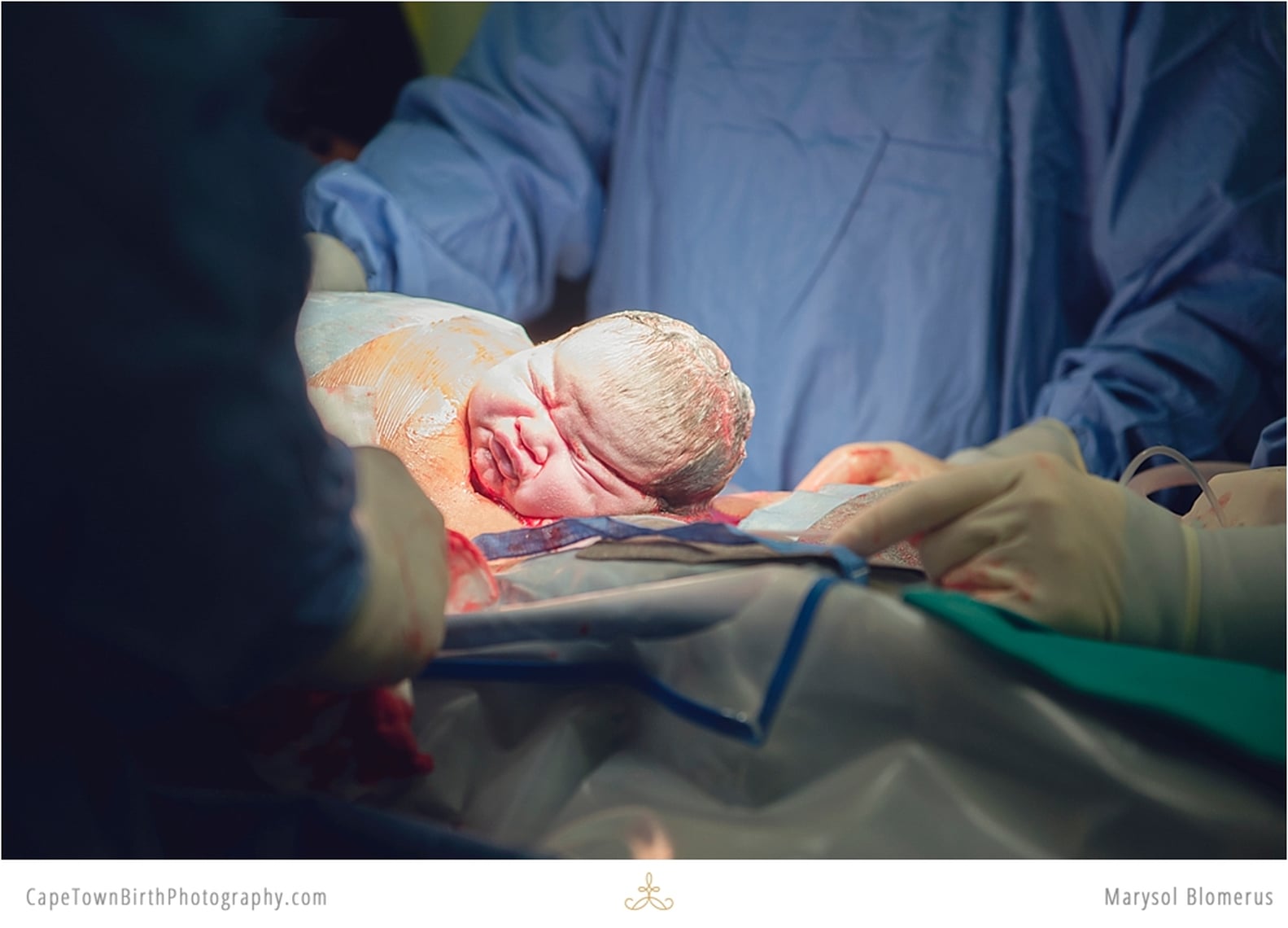 Photos of C-Sections | PS Family