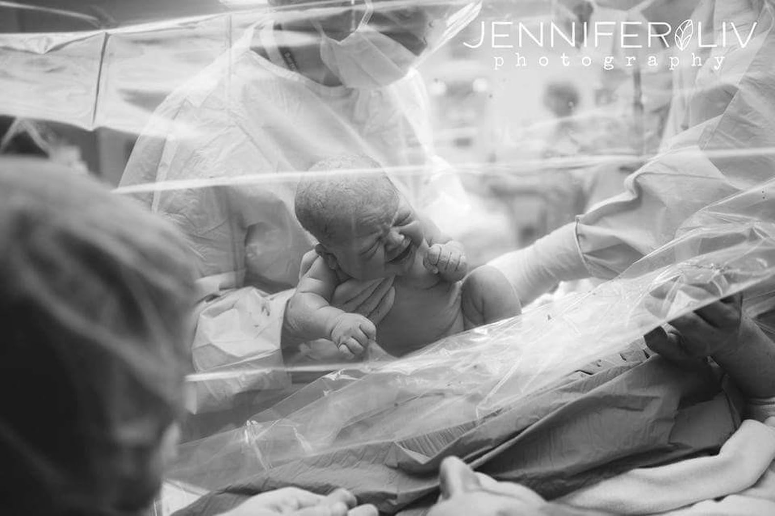 C-Section Birth Photography | POPSUGAR Family