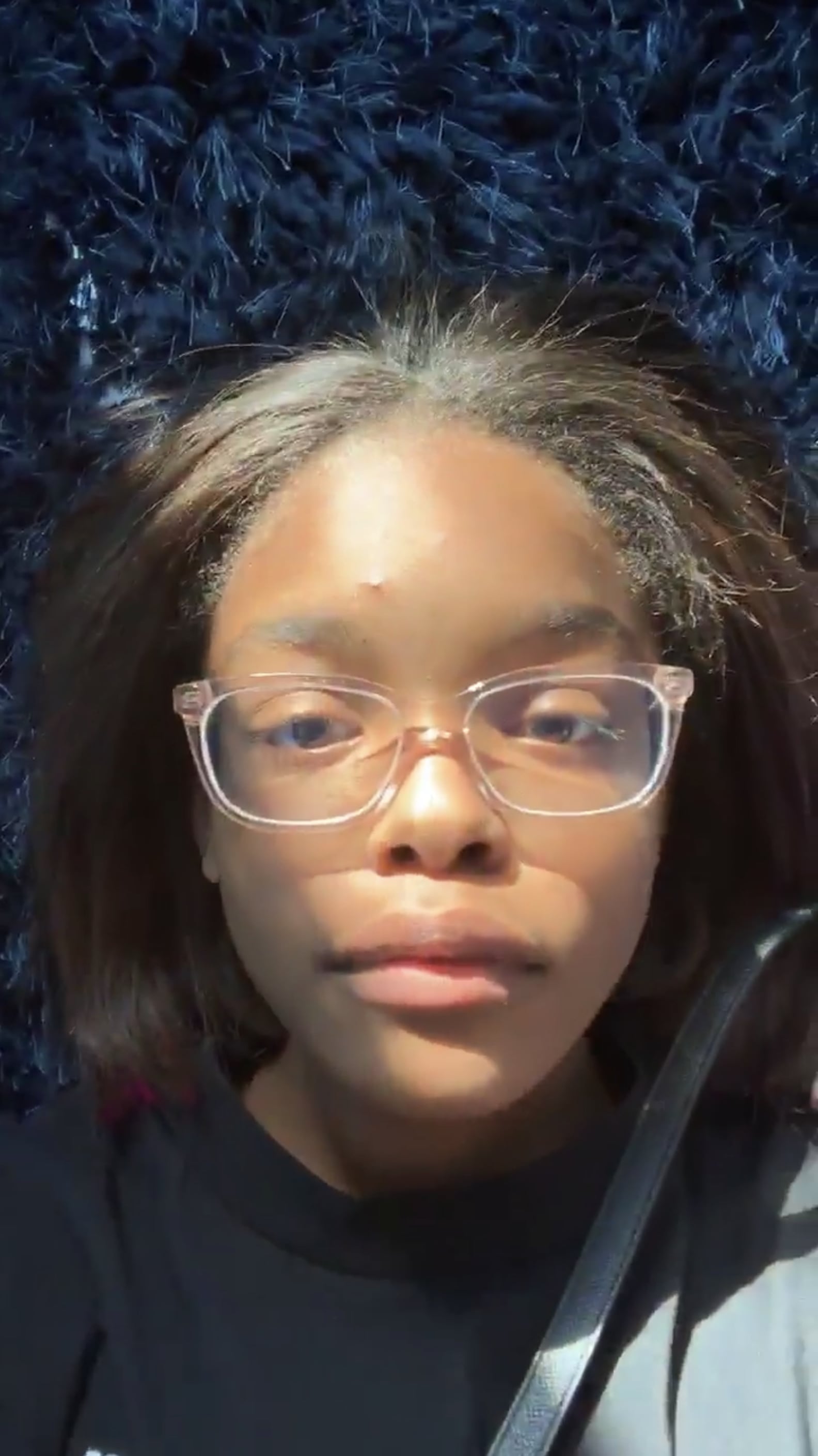 Marsai Martin’s Acne on Instagram | PS Beauty