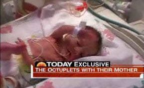 Octuplets | POPSUGAR Moms