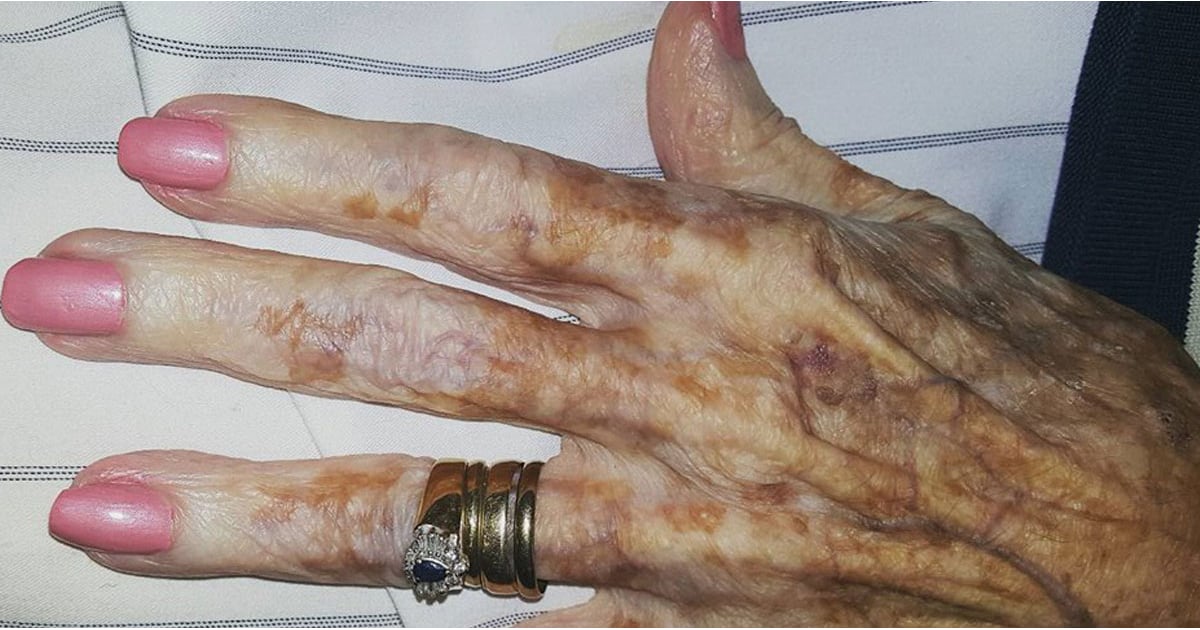 Elderly Woman's Pink Manicure | POPSUGAR Beauty