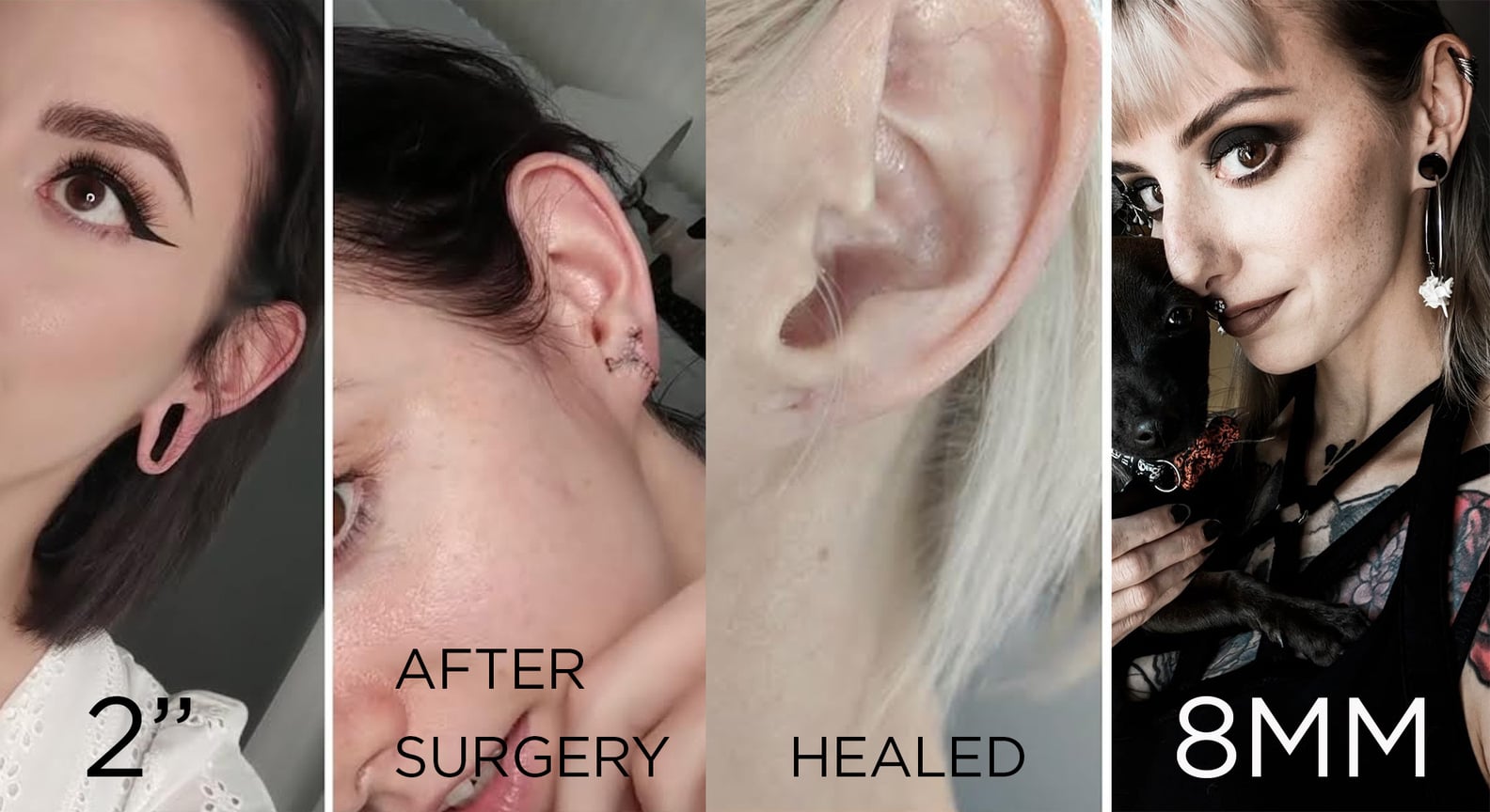 Earlobe Reconstruction Surgery: Cost, Pain, and Risks | POPSUGAR Beauty