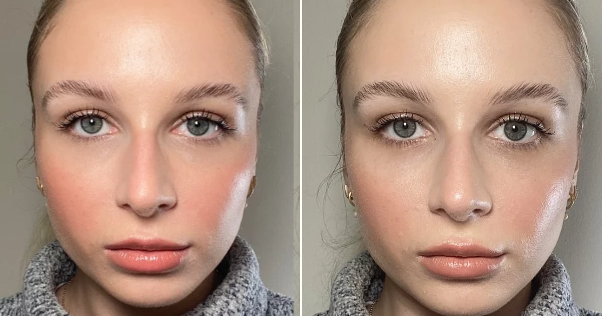 Upneeq Eye Drops Review With Photos | POPSUGAR Beauty