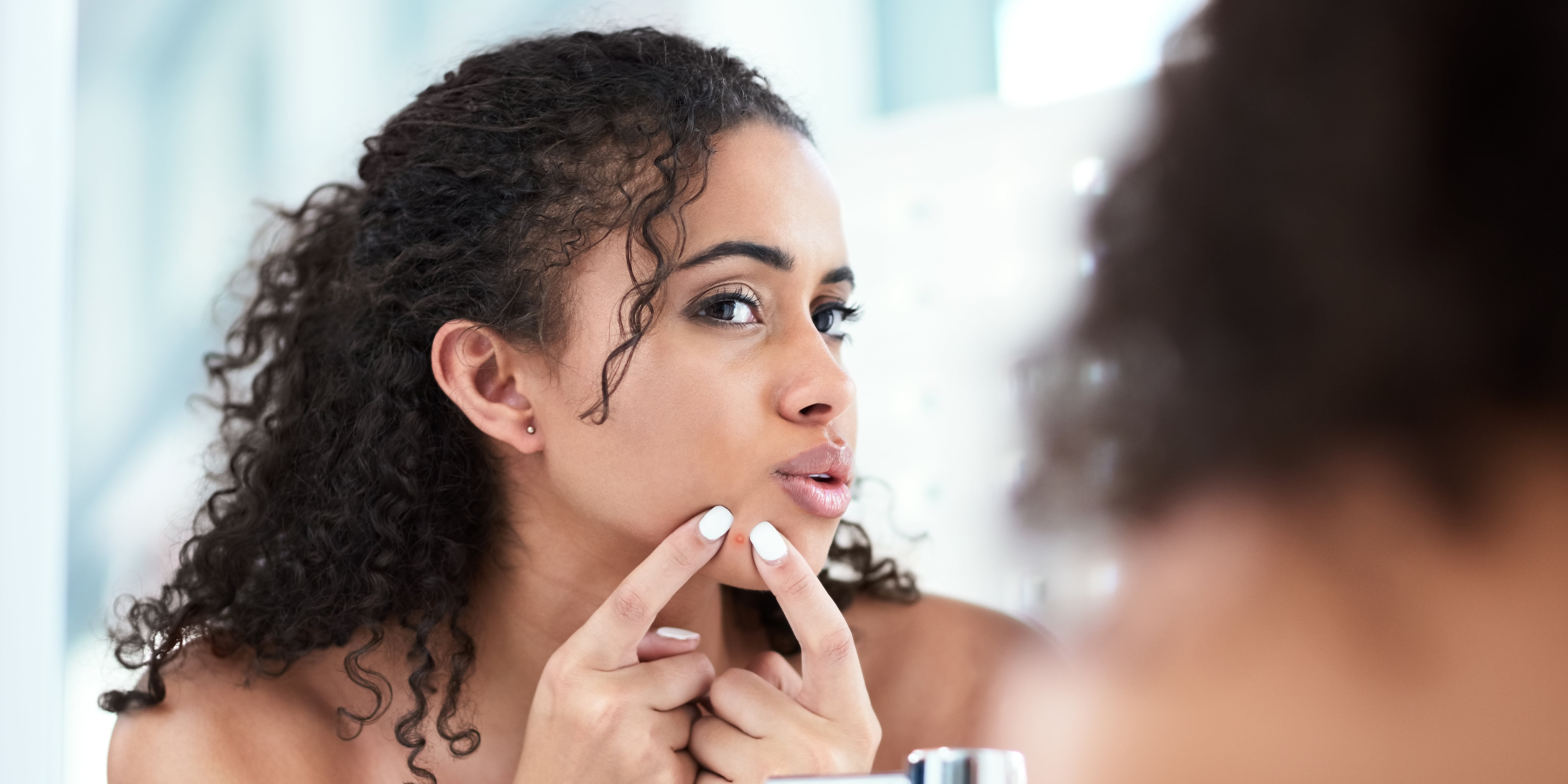 What Is Fungal Acne? How to Treat This Common Acne | POPSUGAR Beauty