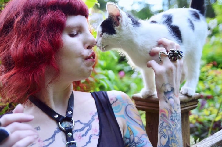 Cat Eye Syndrome Model | POPSUGAR Celebrity